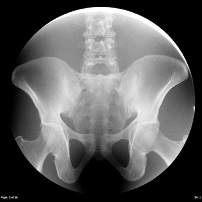 Radiography: Fluoroscopy