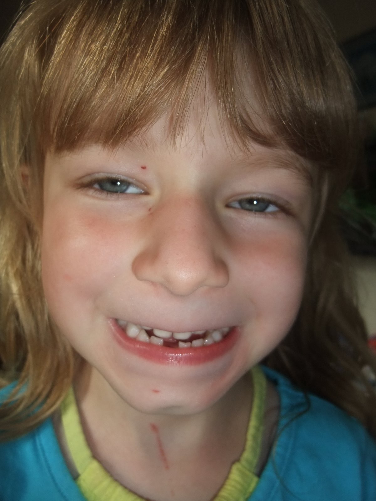 listentomywords-mom: Missing tooth