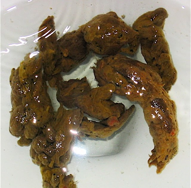 Metamucil Poop Stringy