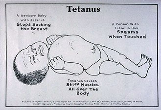 Public Health in Myanmar: Neonatal Tetanus Prevention