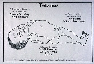 Public Health in Myanmar: Neonatal Tetanus Prevention