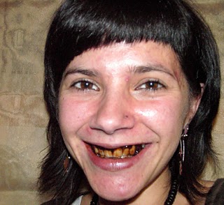 mundo loko: OS dentes mais podres!