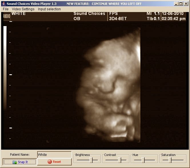 Counting Our Blessings: Jaxon's 4D Ultrasound @ 31 Weeks
