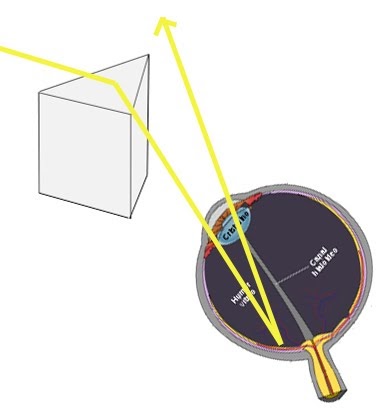 Tecnología Médica - Mención en Oftalmología: Prisma Cover Test