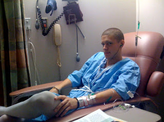 Ulcerative Colitis J-Pouch Surgery