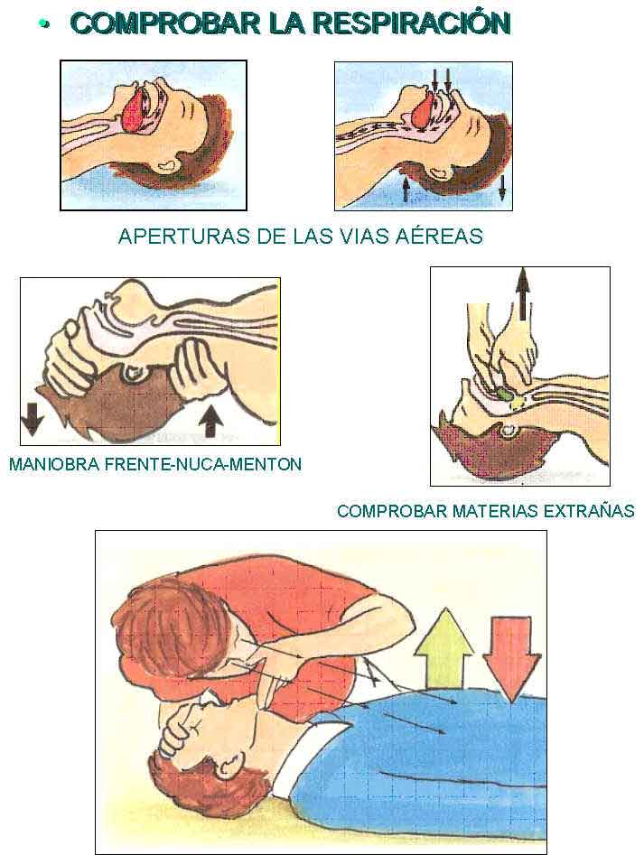 Educación Física en la Red: Pasos en la RCP (Reanimación Cardiopulmonar)
