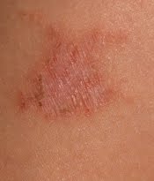 Remedios Naturales y Medicina Alternativa: Cómo tratar y prevenir la ...