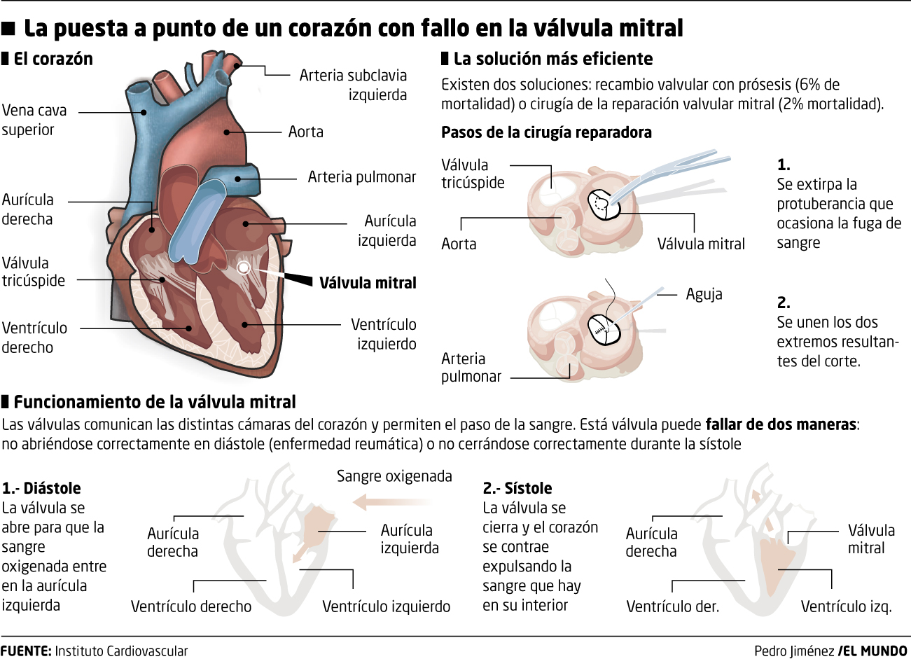 Infografia periodistica y diseño gráfico: Puesta a punto de un corazón ...