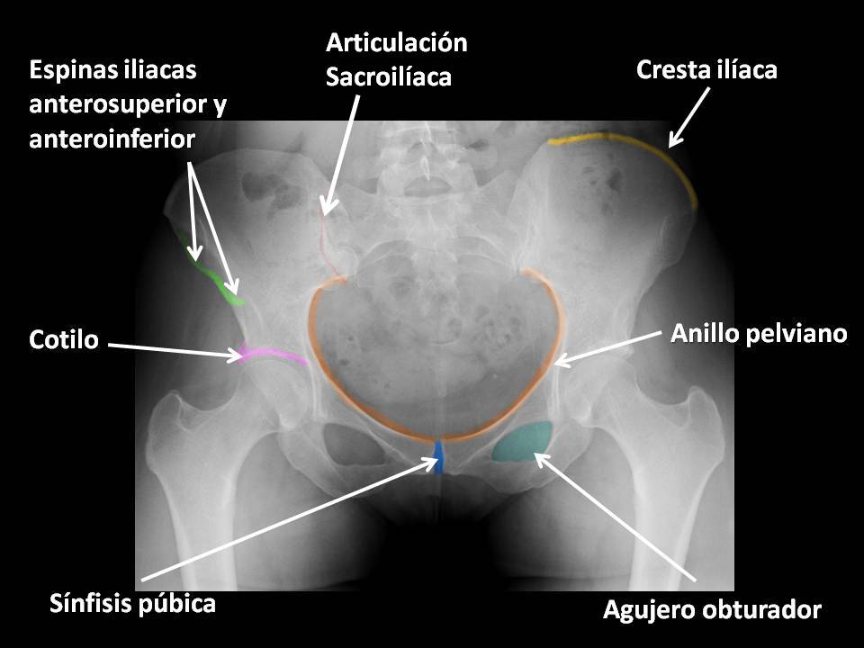 Portafolio Digital: Radioshop: Radiografía de Pelvis