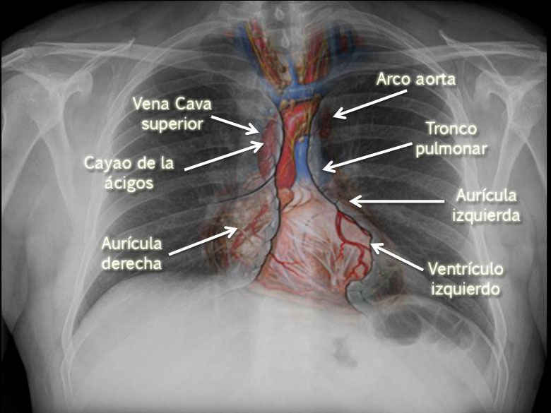 Portafolio Digital: Radioshop: Radiografía de Tórax