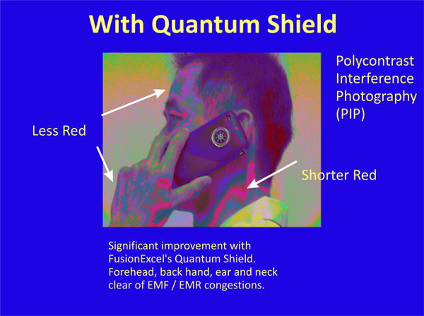 Probiotics for Mankind.