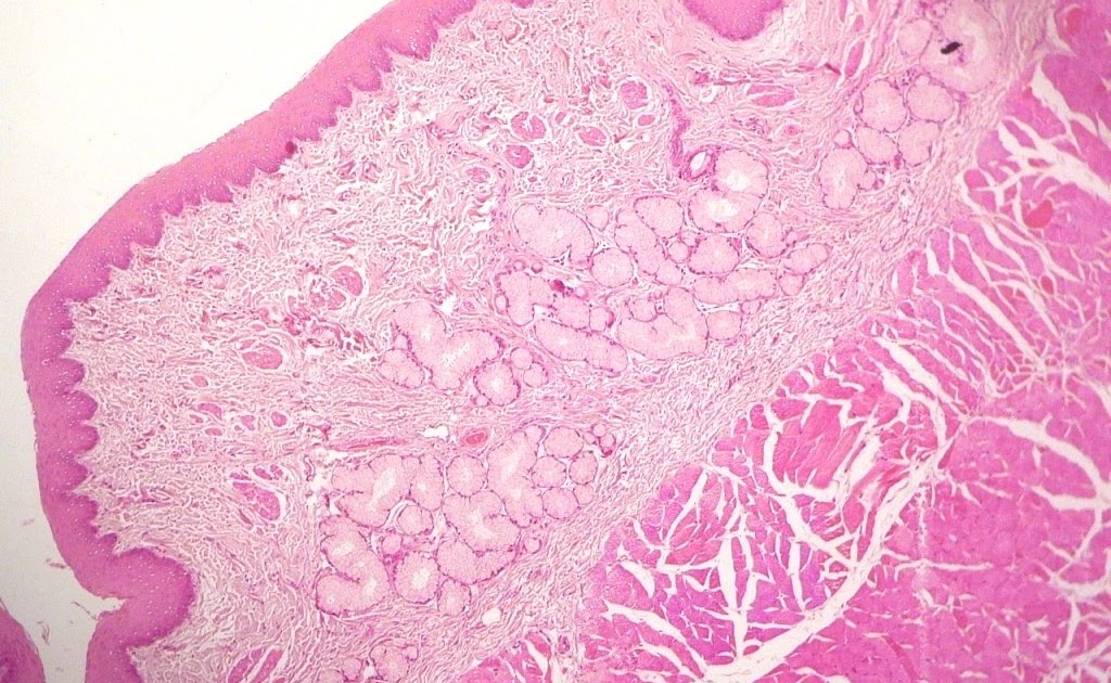 HISTOLOGIA DE LA BOCA: LABIO