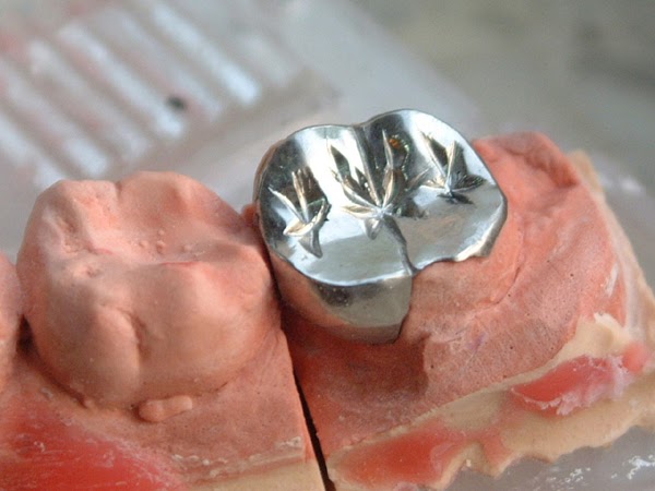 Låßø®åtø®î§tå§: υnιdad coladoѕ™