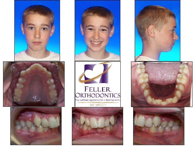 Feller Orthodontics
