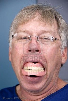 A new day A new experience: False Teeth