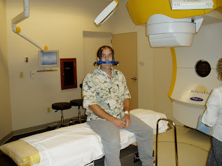 Life with Trigeminal Neuralgia: Novalis TX Radiation Surgery