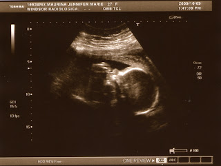 ...and baby makes three!: 24 week ultrasound