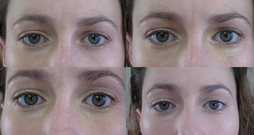 Caitlin Chic: How to Fake a Wide Awake Look