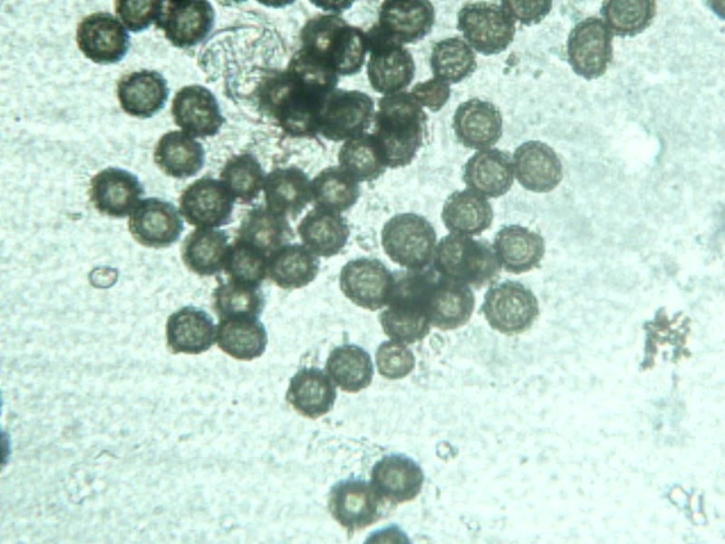 MICOLOGIA PANAMENSIS: NOTAS MICOLOGICAS (17). OBSERVACIONES SOBRE EL ...