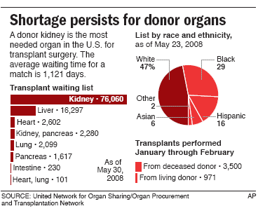 MrgDX: Can I sell my kidney's? or Is it really worth a arm and a leg?