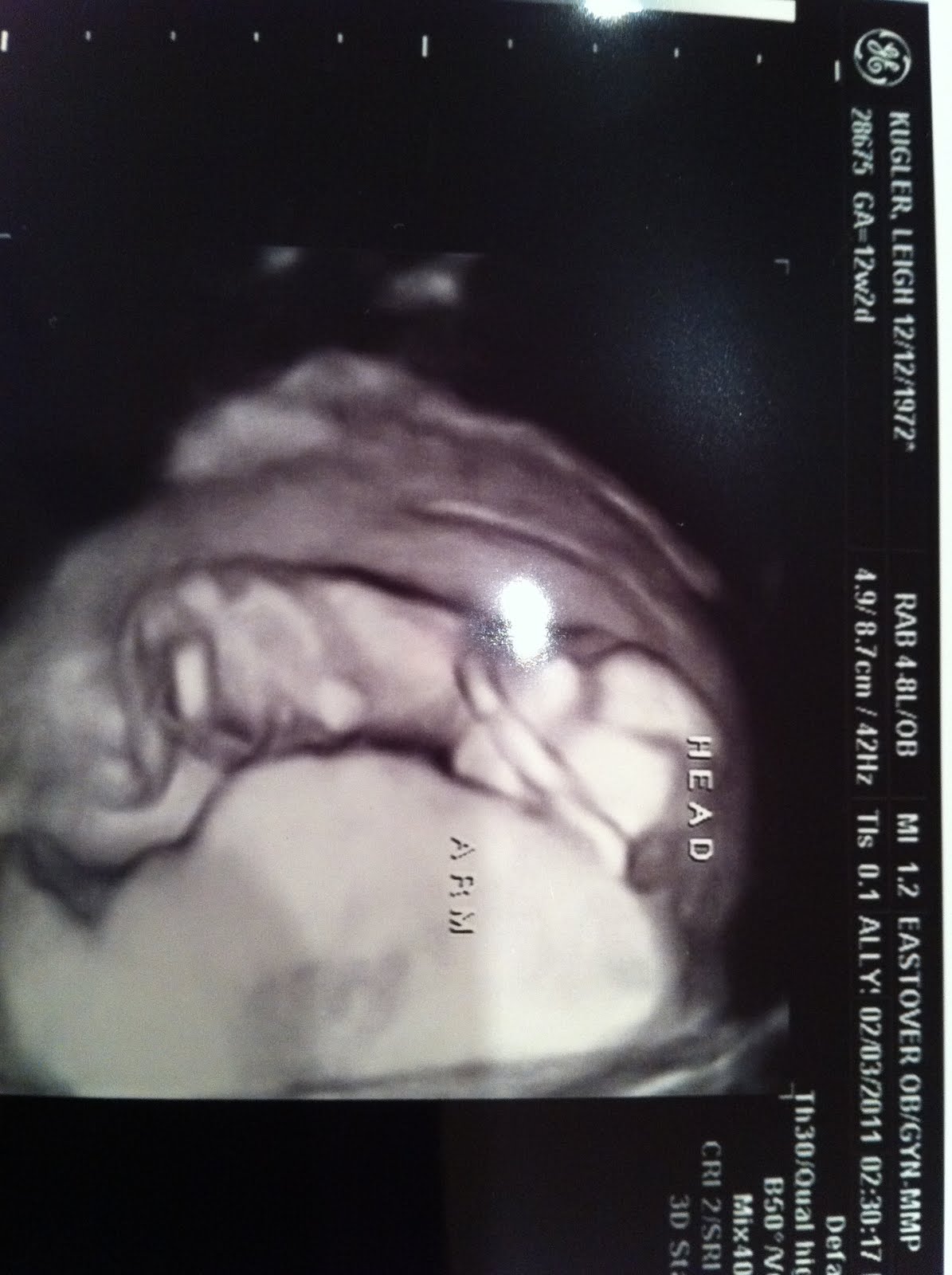 The Kugler Family Adventures: 12 Week Ultrasound/Genetic Testing