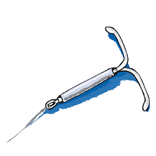 metodos: Lo que debes saber de un aborto parte 2