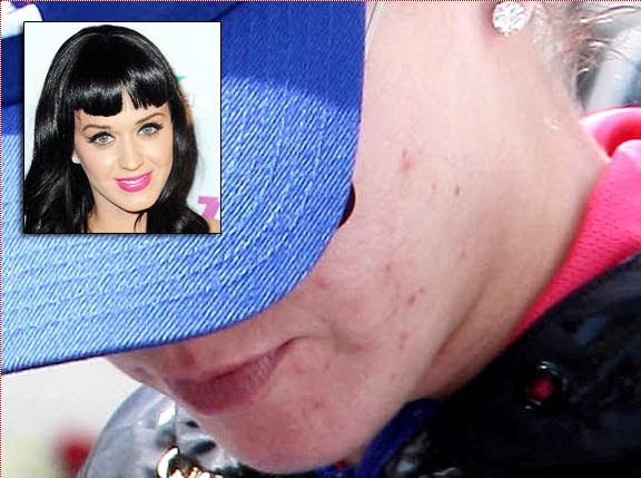 Katy Perry'nin Makyajsız Yüzü ve Proactiv | Deniz Havası