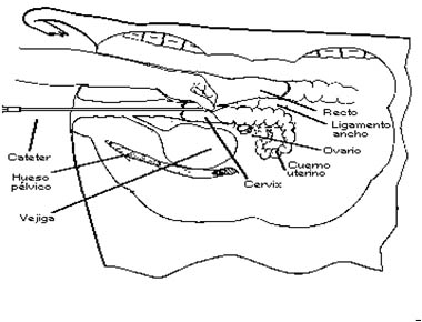 REPROGEN-BOVINOS: INSEMINACION ARTIFICIAL