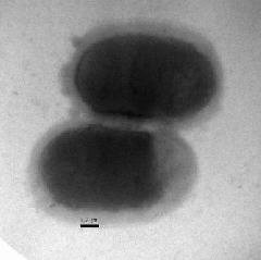 MUNDO AQUARIO: Furunculose