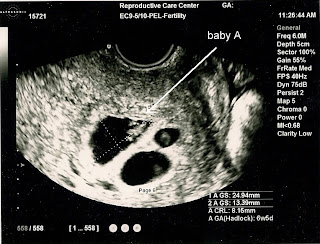 OMG ITS TRIPLETS: ITS TRIPLETS..OMG