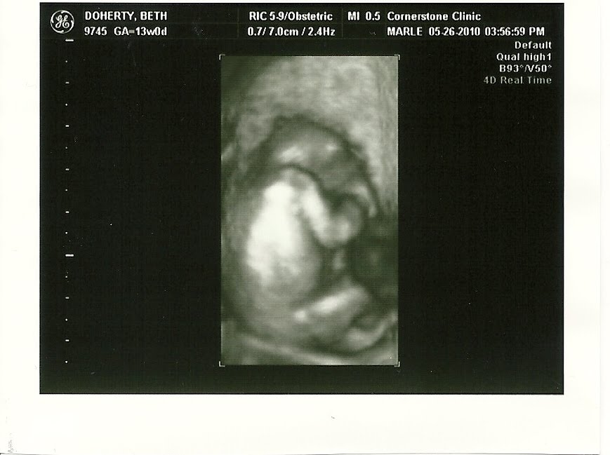 The Doherty Dish: Baby at 13 Weeks