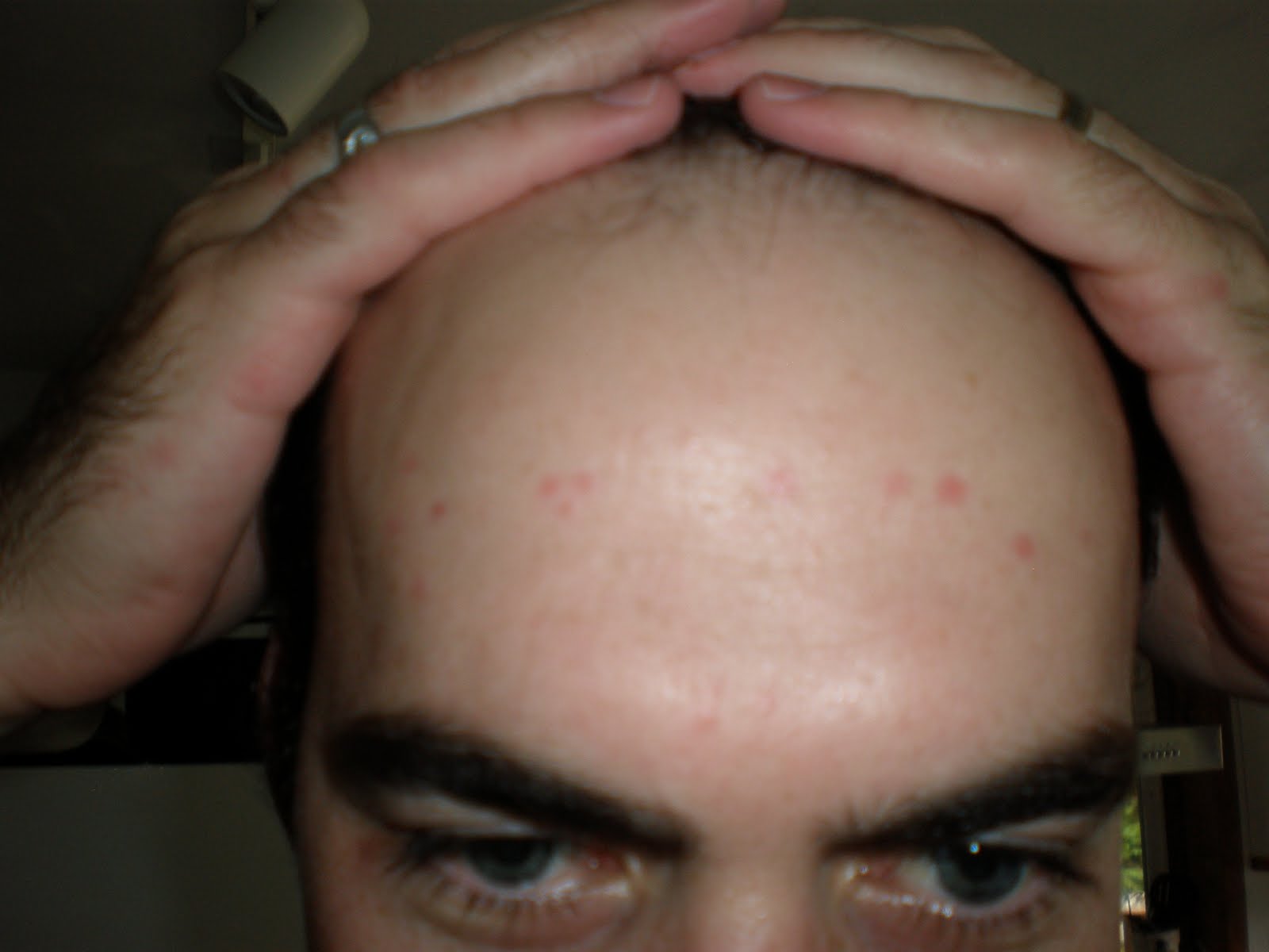 The Reeses: Mosquitos & No-See-Ums