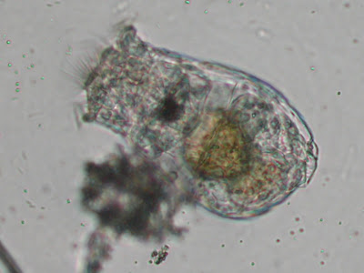 BLOG OF SCIENCE!: Rotifer Photos