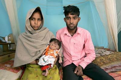 The Virtual World: Baby Born With Two Faces