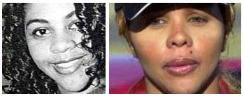 Plastic Surgery Before And After: Lil Kim Plastic Surgery Pictures