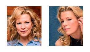 Plastic Surgery Before After: Kim Basinger Plastic Surgery