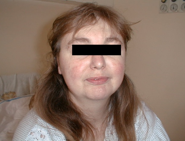 la maldición de observarlo todo: Facies