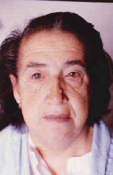 Semiologia Quirurgica: Tipos de facies: Acromegalia, Cushing, Mixedema ...