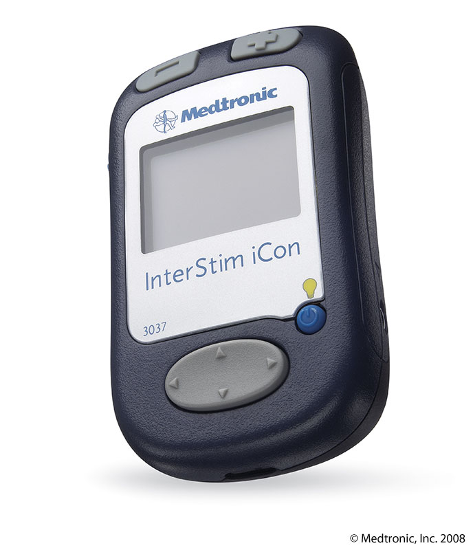 Interstim Anyone?: Let's start from the beginning.