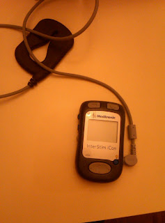 Interstim Anyone?: Satuday - Wednesday's update. and Stage 2