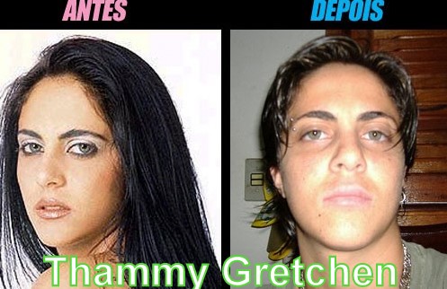 Thammy Miranda Antes E Depois