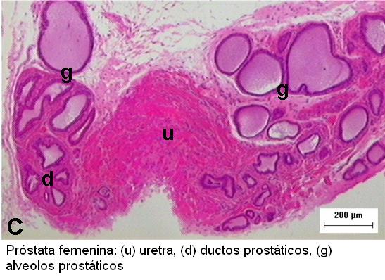 Madrid Urología: Glandula de Skene. La próstata en la mujer