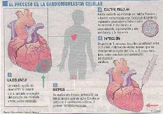 bioetica-pilumdigital: Recuperación de un corazón infartado