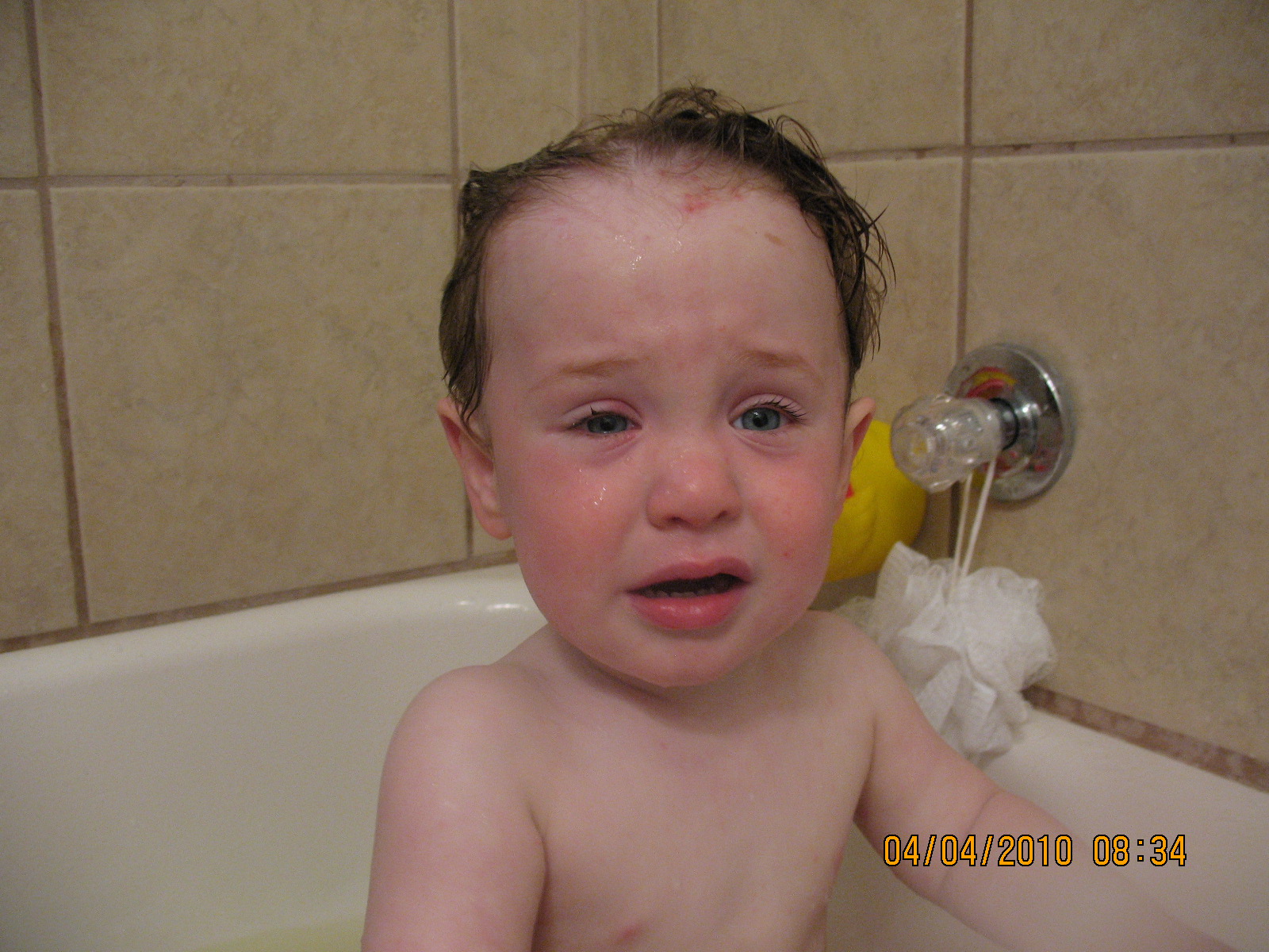 4EVER BLESSED: McLean Party of Eight: CHICKEN POX!!!!!