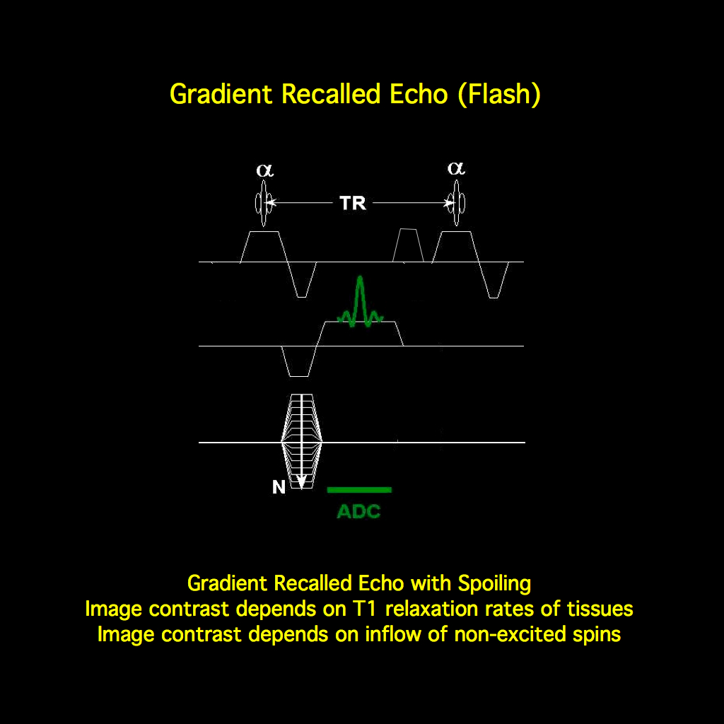 MRI BLOG: Pulse Sequences for Cardiac MRI