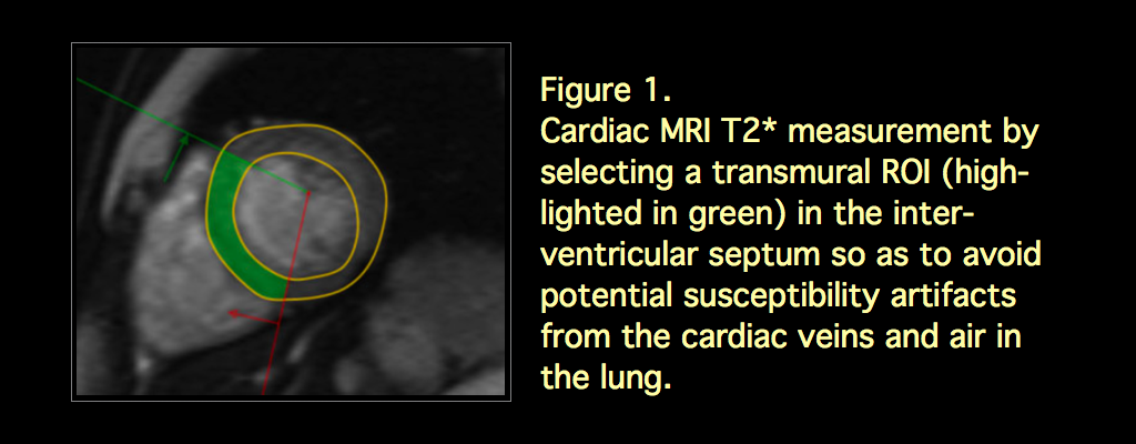 MRI BLOG: T2* Measurement of Myocardial Iron in Thalassemia (Part I)