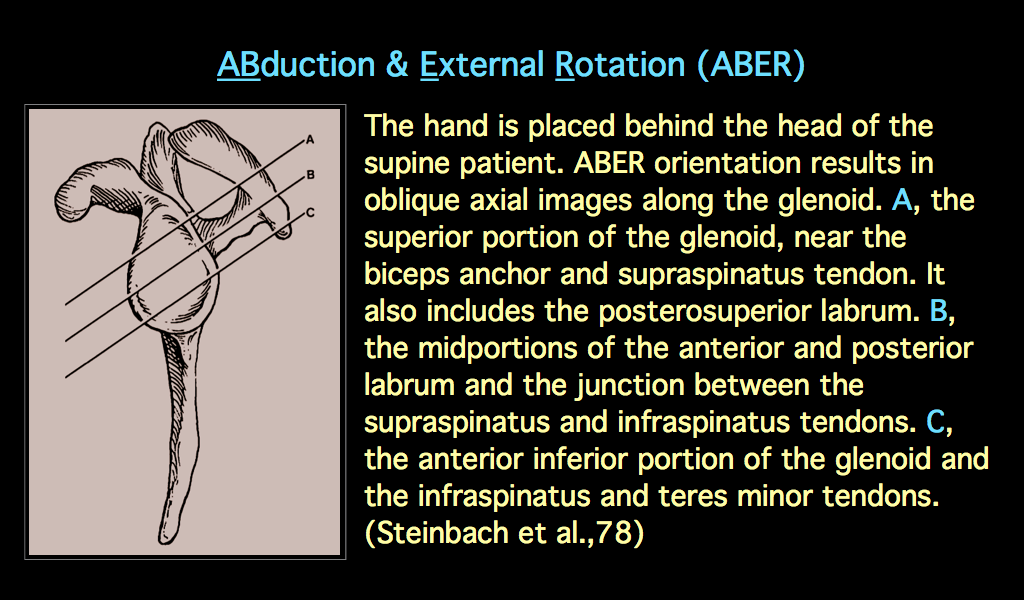 MRI BLOG: Shoulder MRI