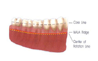 ORTODONTIA CONTEMPORÂNEA: Borda WALA e sua determinação como ponto de ...
