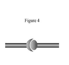 Dermatology Top Secrets: Hair shaft abnormalities