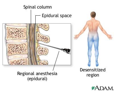 Doctors Gates: Agents for Spinal anesthesia